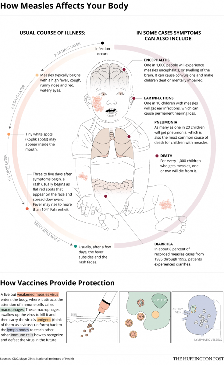 A roundup of measles outbreak visualizations, maps and interactives ...